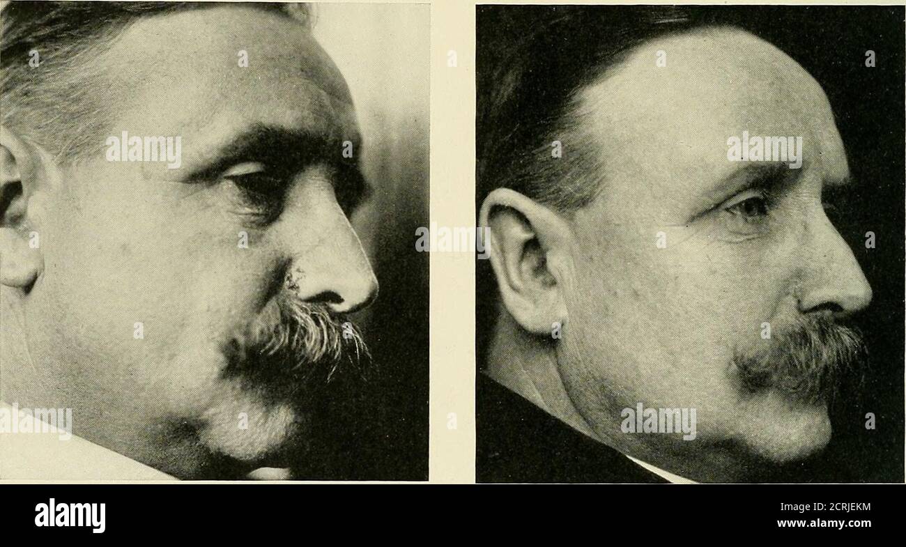 . Radiography, x-ray therapeutics and radium therapy . PLATE LIX ...