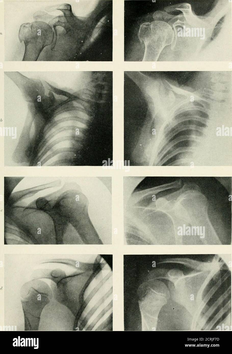 . Radiography, X-ray therapeutics and radium therapy . PLATE X ...