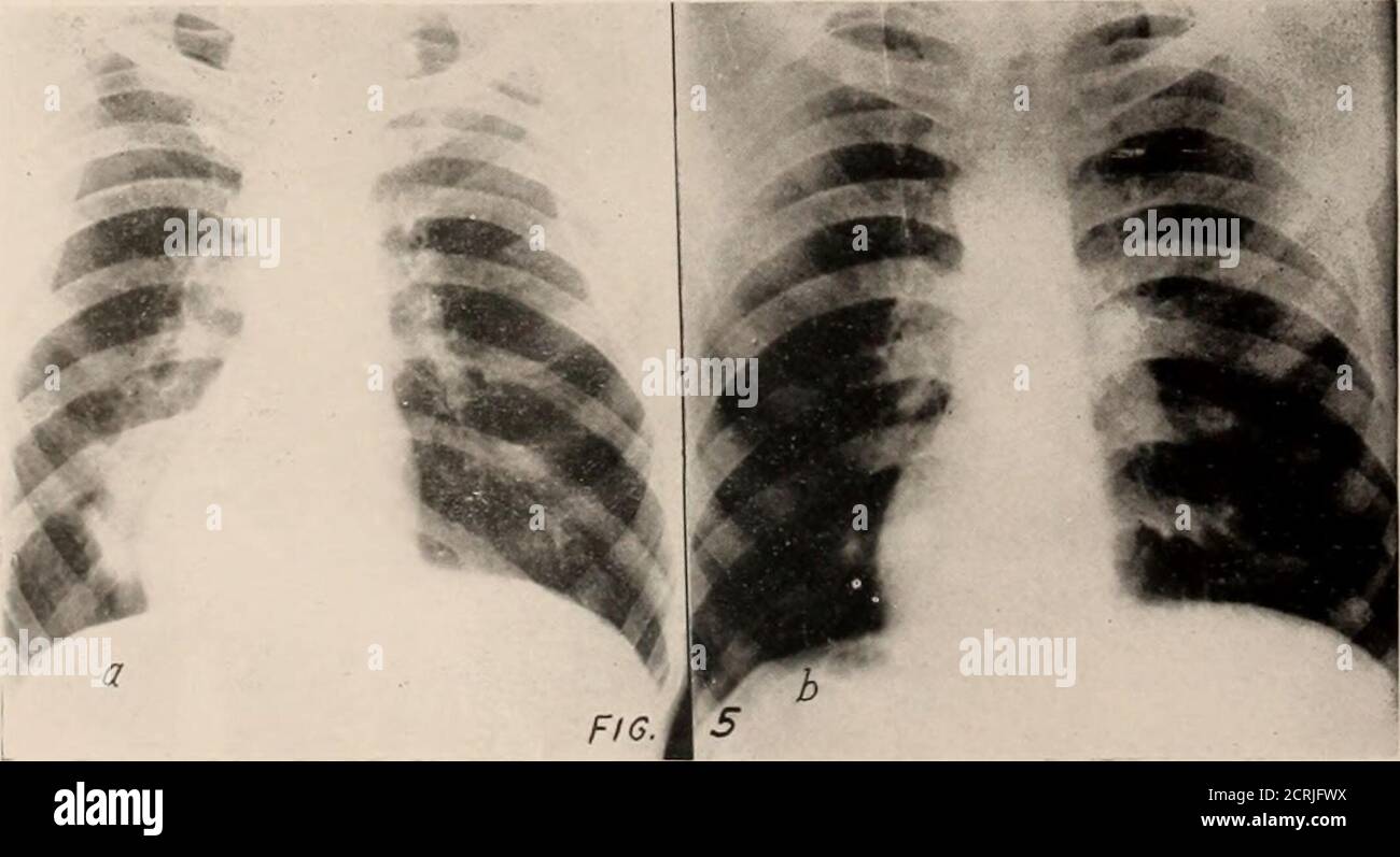 Radiographic studies hi-res stock photography and images - Alamy