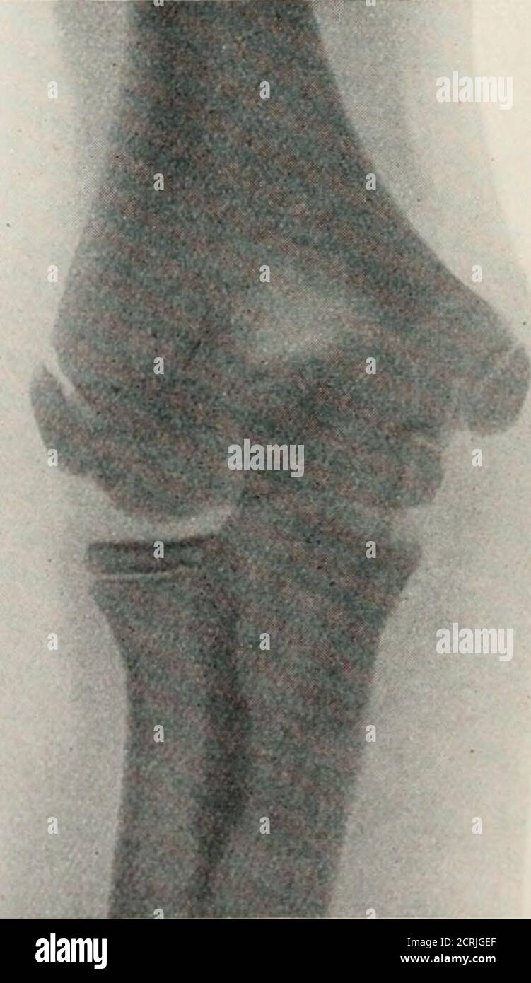 . Radiography, X-ray therapeutics and radium therapy . PlO. 123 ...