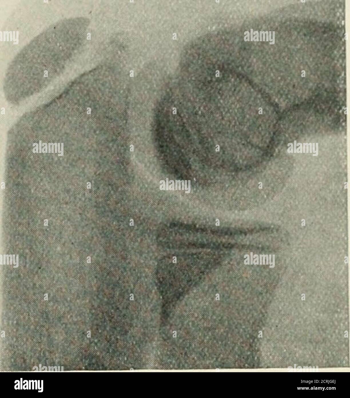 . Radiography, X-ray therapeutics and radium therapy . PlO. 123 ...