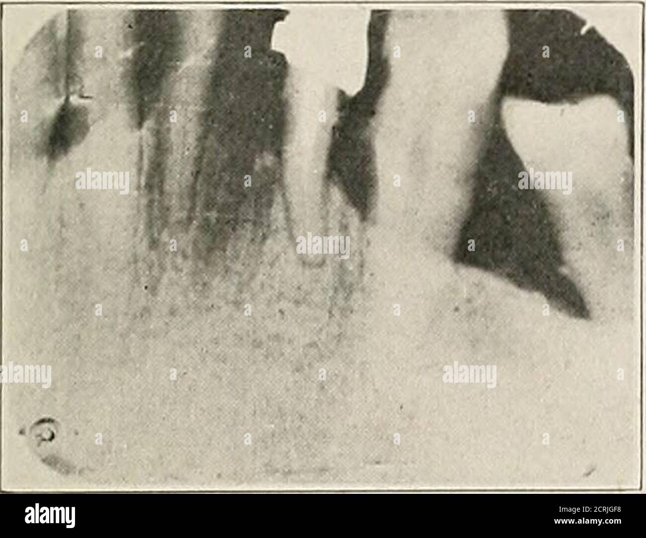 Alveolar septa hi-res stock photography and images - Alamy