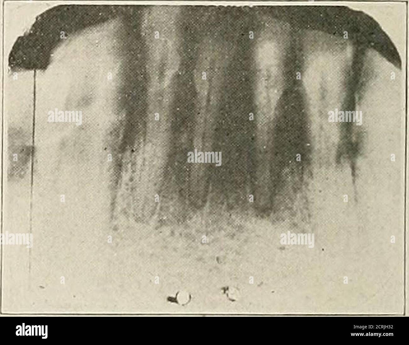 . Interpretation of dental and maxillary roentgenograms . Fig. 172. Fig ...