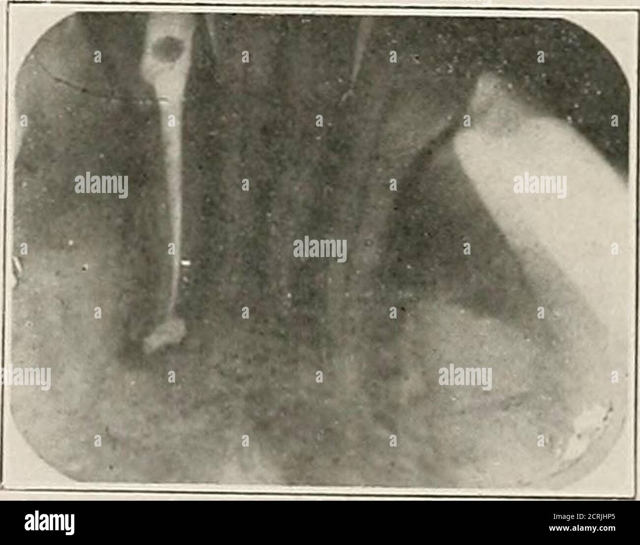 . Interpretation of dental and maxillary roentgenograms . Fig. 168. Fig ...