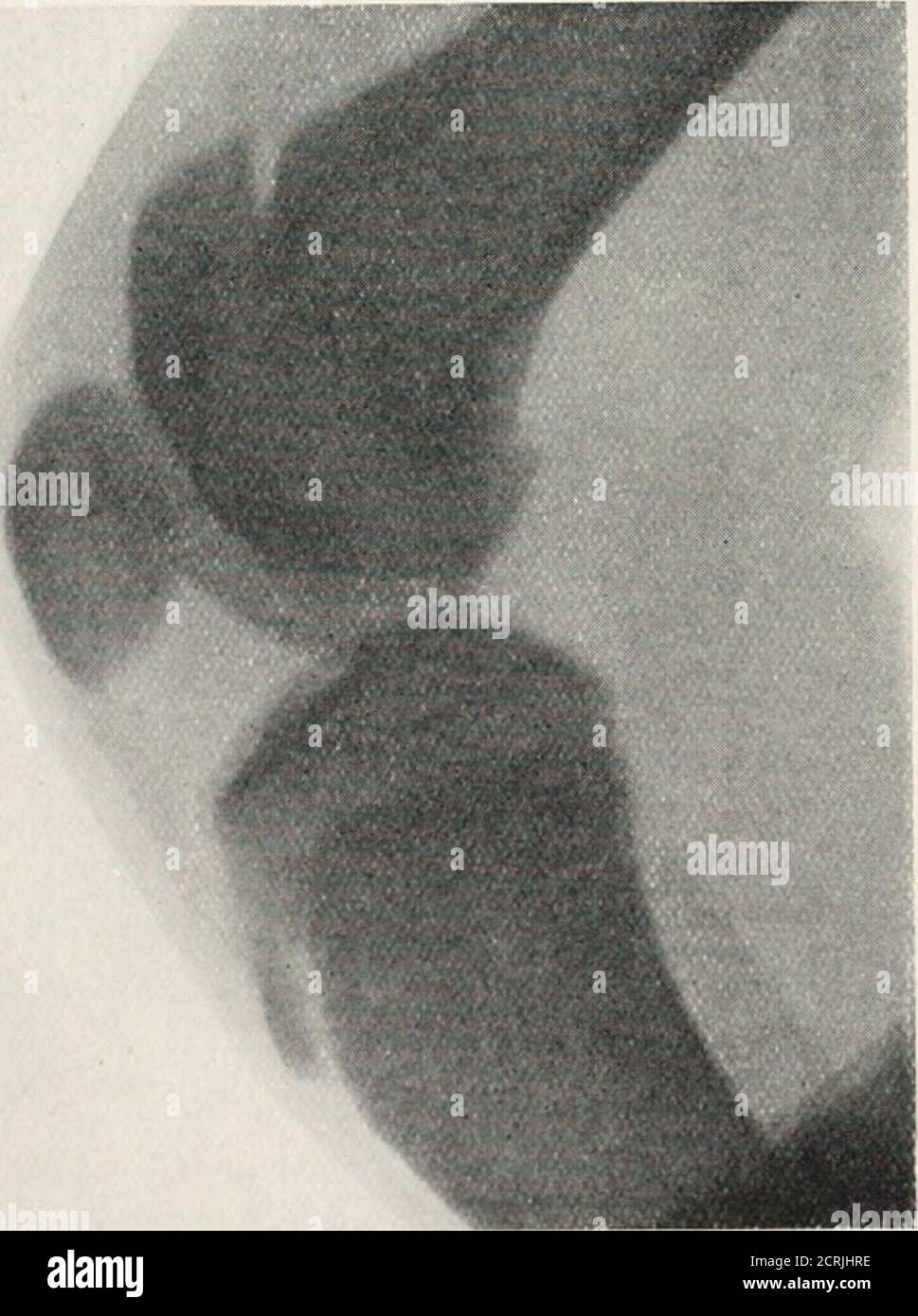 . Radiography, X-ray therapeutics and radium therapy . Anteroposterior ...