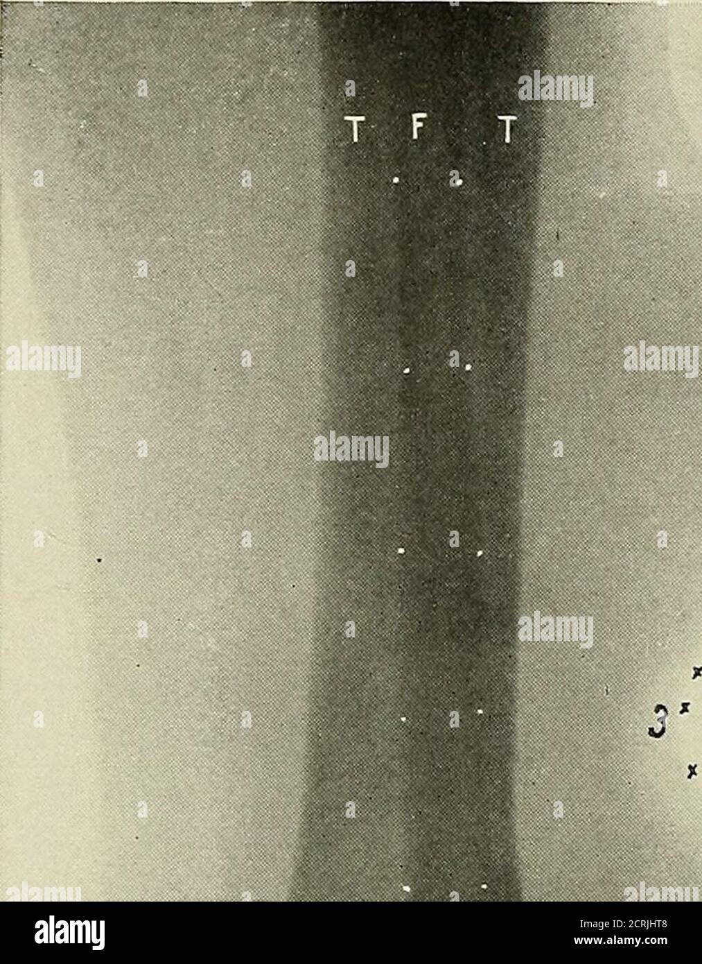 . Röntgen rays and electro-therapeutics : with chapters on radium and ...