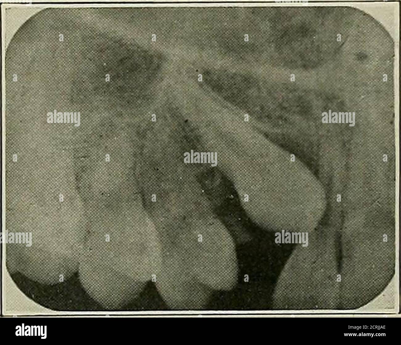 . Dental and oral radiography; a textbook for students and ...