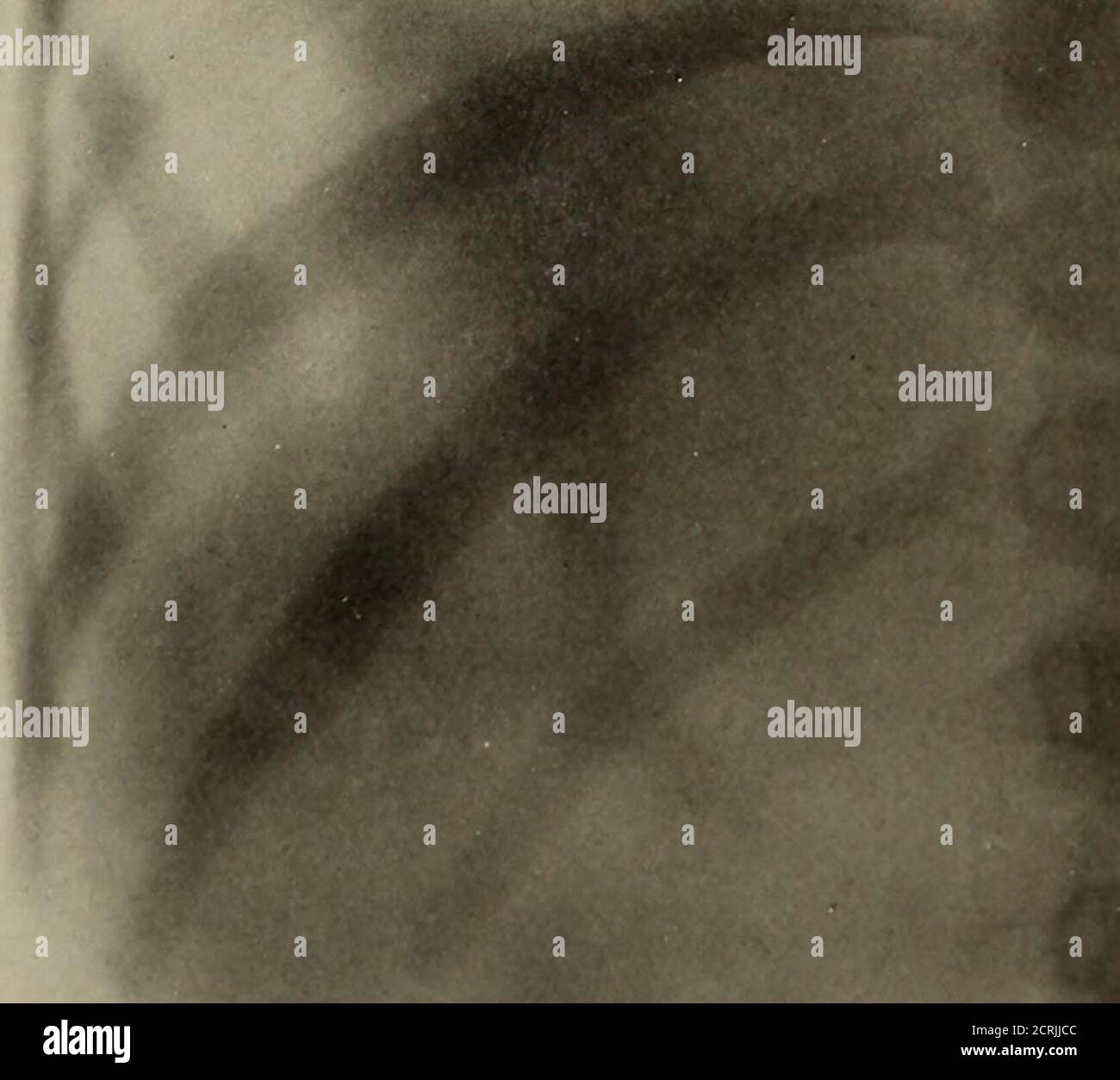 . Living anatomy and pathology Stock Photo - Alamy