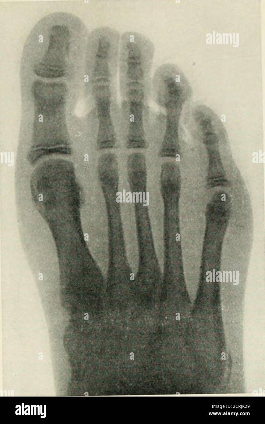. Radiography, X-ray therapeutics and radium therapy . FlG. 111 ...