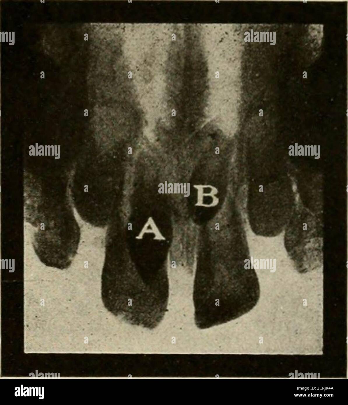 . Elementary and dental radiography / by Howard Riley Raper . Fig. 153 ...