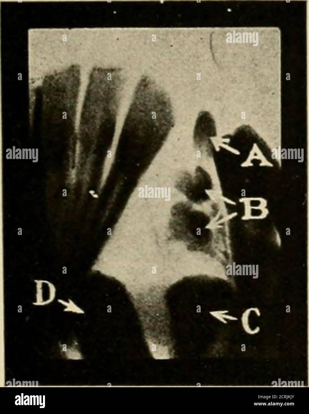 . Elementary and dental radiography / by Howard Riley Raper . made ...