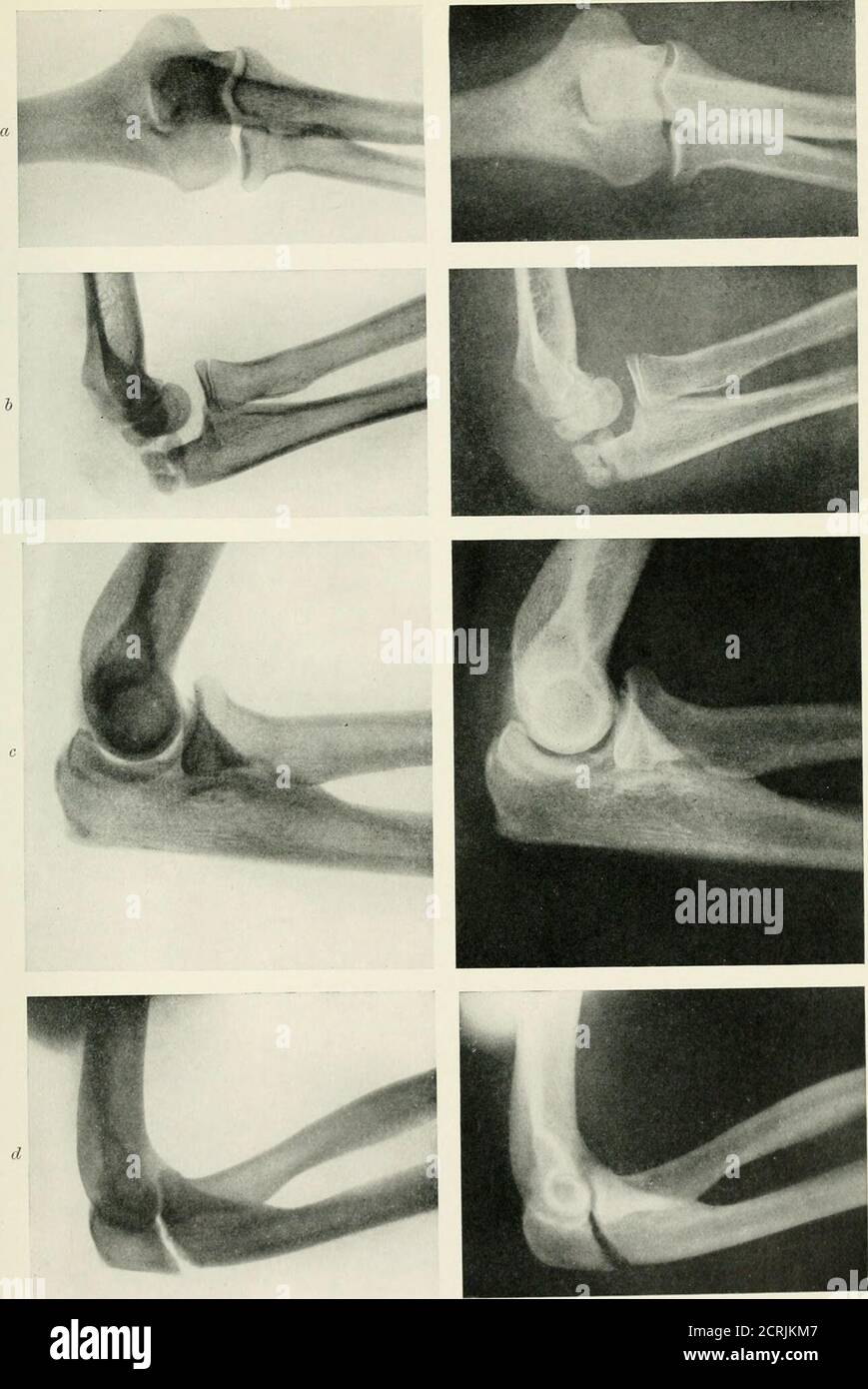 . Radiography, X-ray therapeutics and radium therapy . ppears very ...