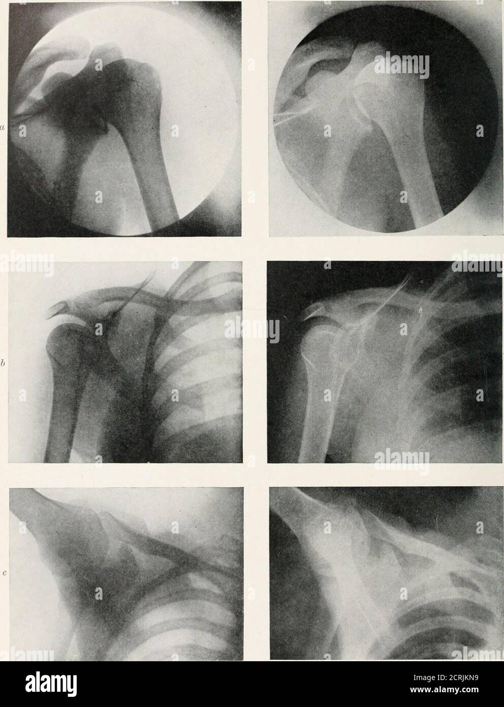 . Radiography, X-ray therapeutics and radium therapy . he forearmflexed ...