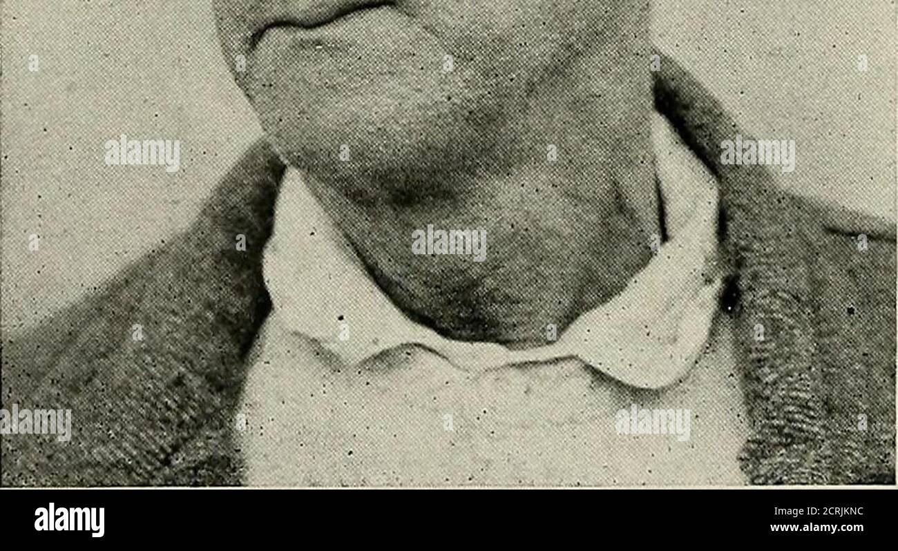 Radium 225 hi-res stock photography and images - Alamy