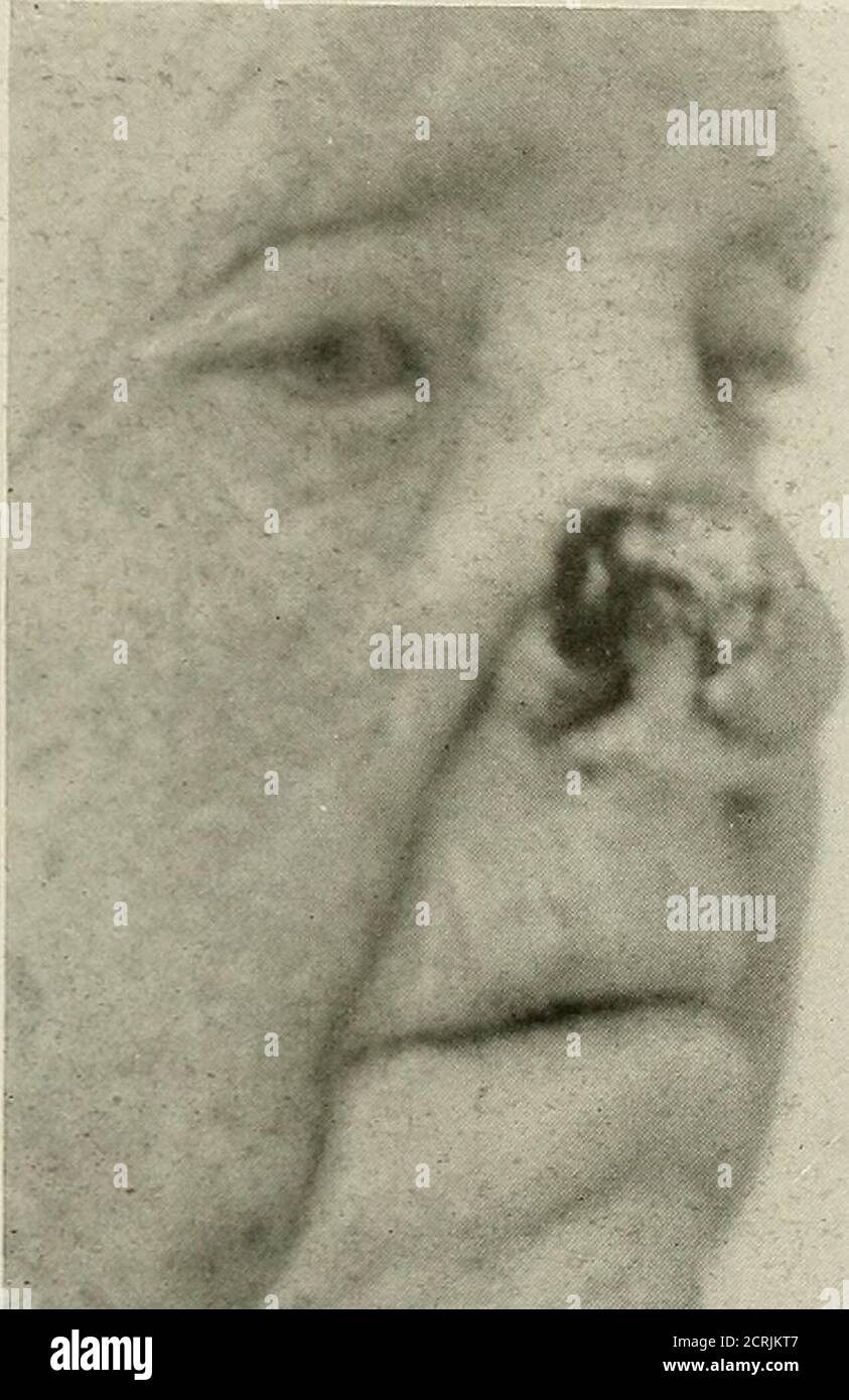 Radium 225 hi-res stock photography and images - Alamy