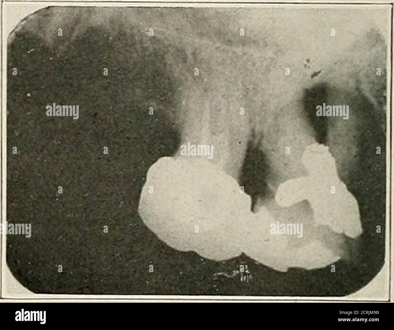 Normal perforation hi-res stock photography and images - Alamy