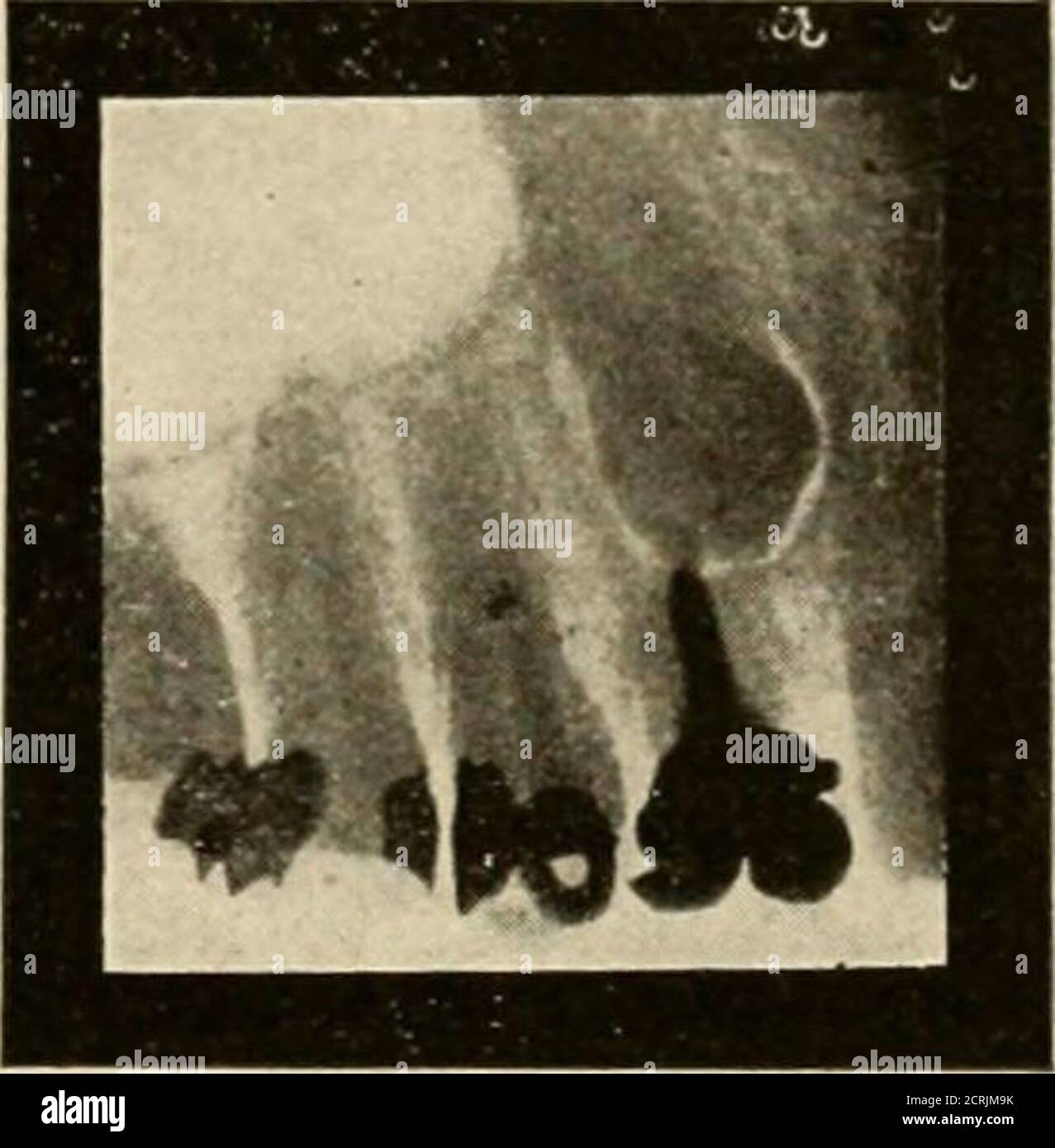 . Elementary and dental radiography / by Howard Riley Raper . four ...