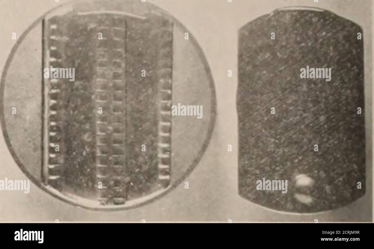 Brass cancer hi-res stock photography and images - Alamy