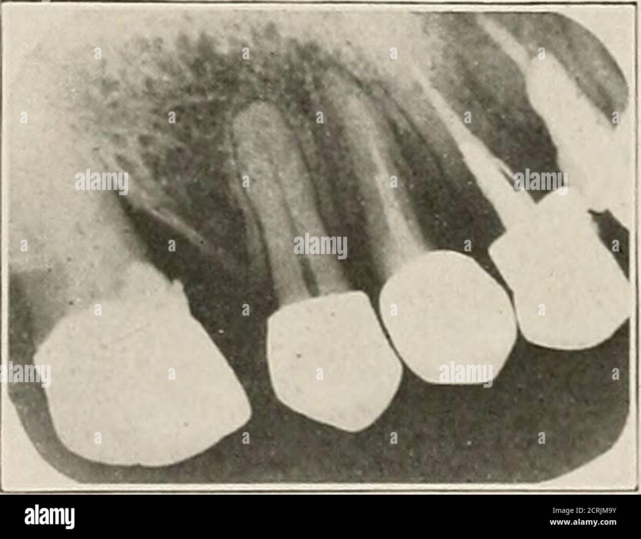 Normal perforation hi-res stock photography and images - Alamy