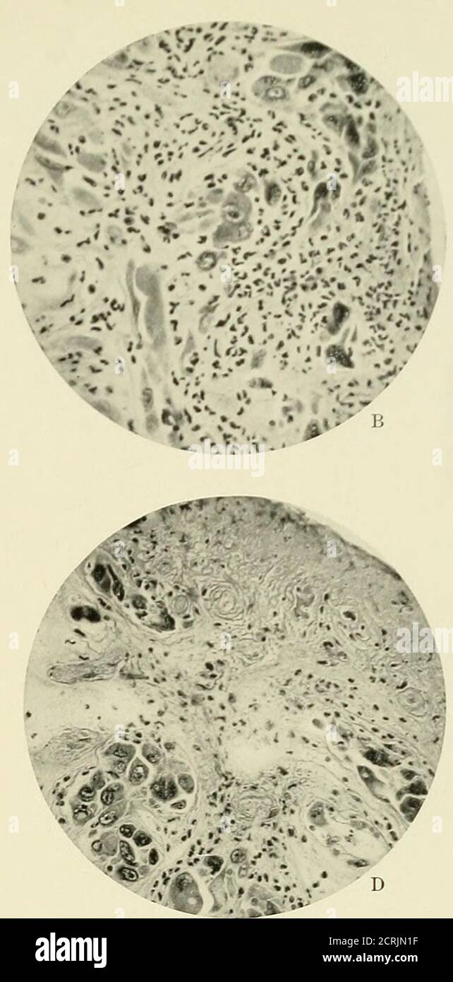 Growth plate x ray hi-res stock photography and images - Alamy