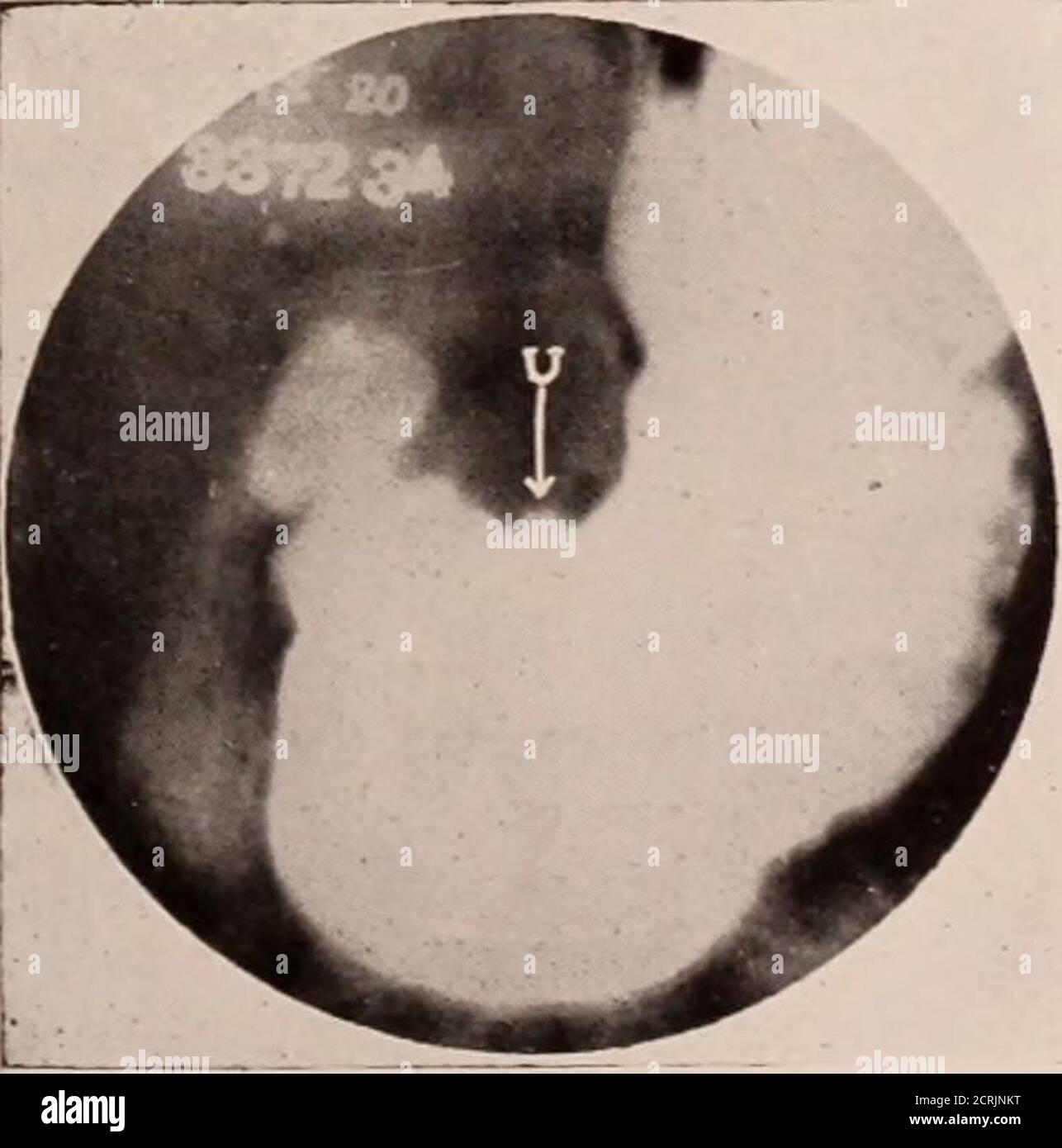 Right upper quadrant hi-res stock photography and images - Alamy
