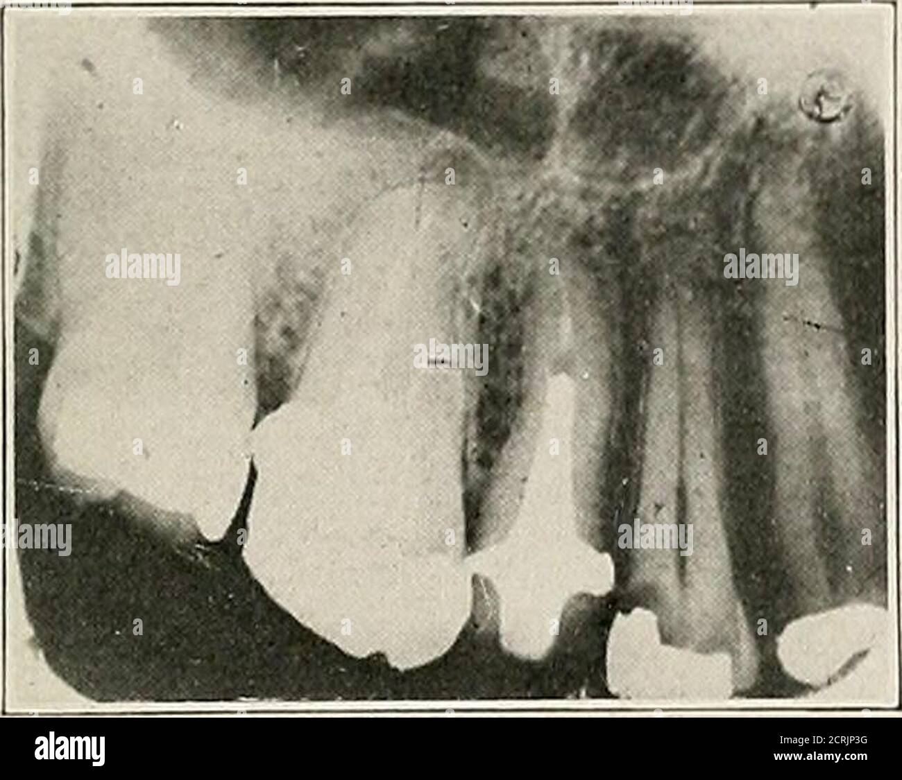 . Interpretation of dental and maxillary roentgenograms . Fig. 132. Fig ...