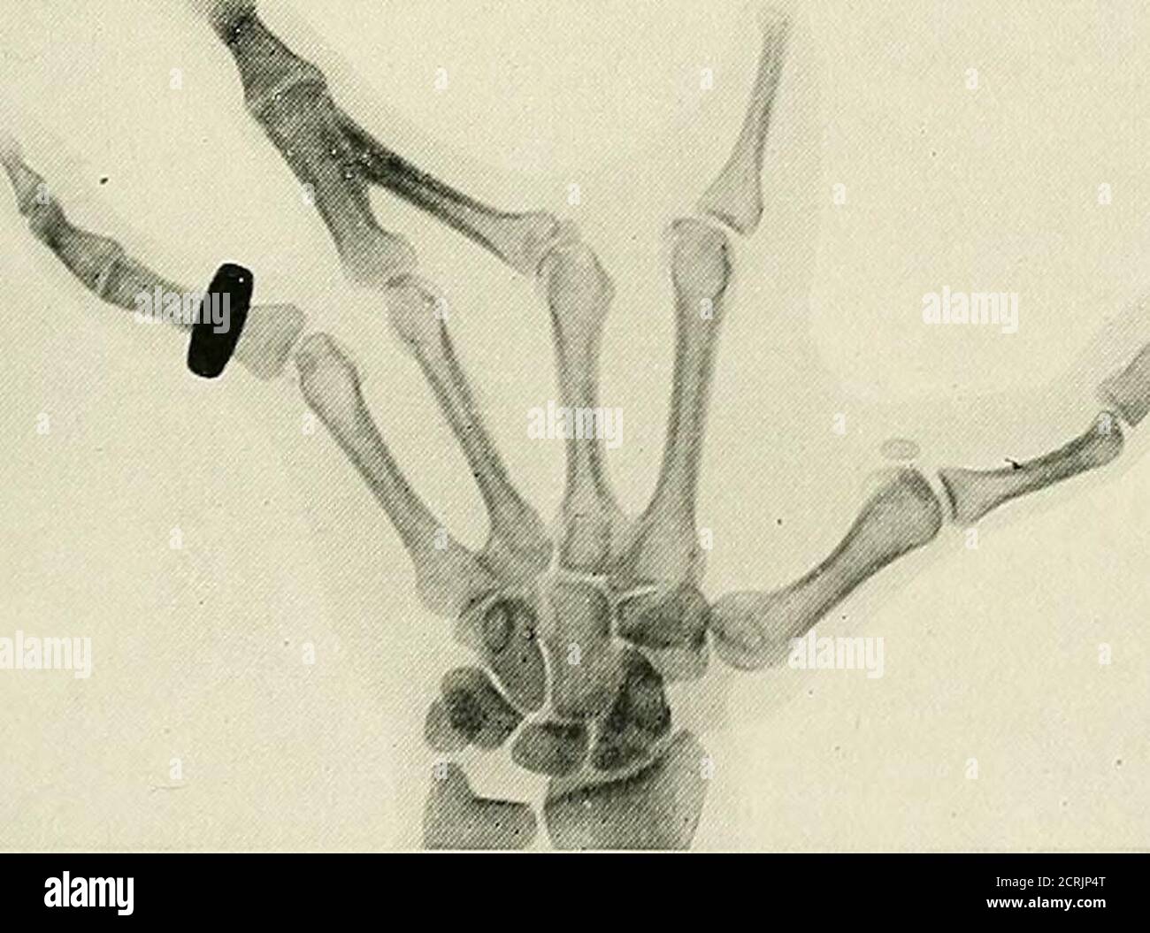 . Radiography, x-ray therapeutics and radium therapy Stock Photo - Alamy