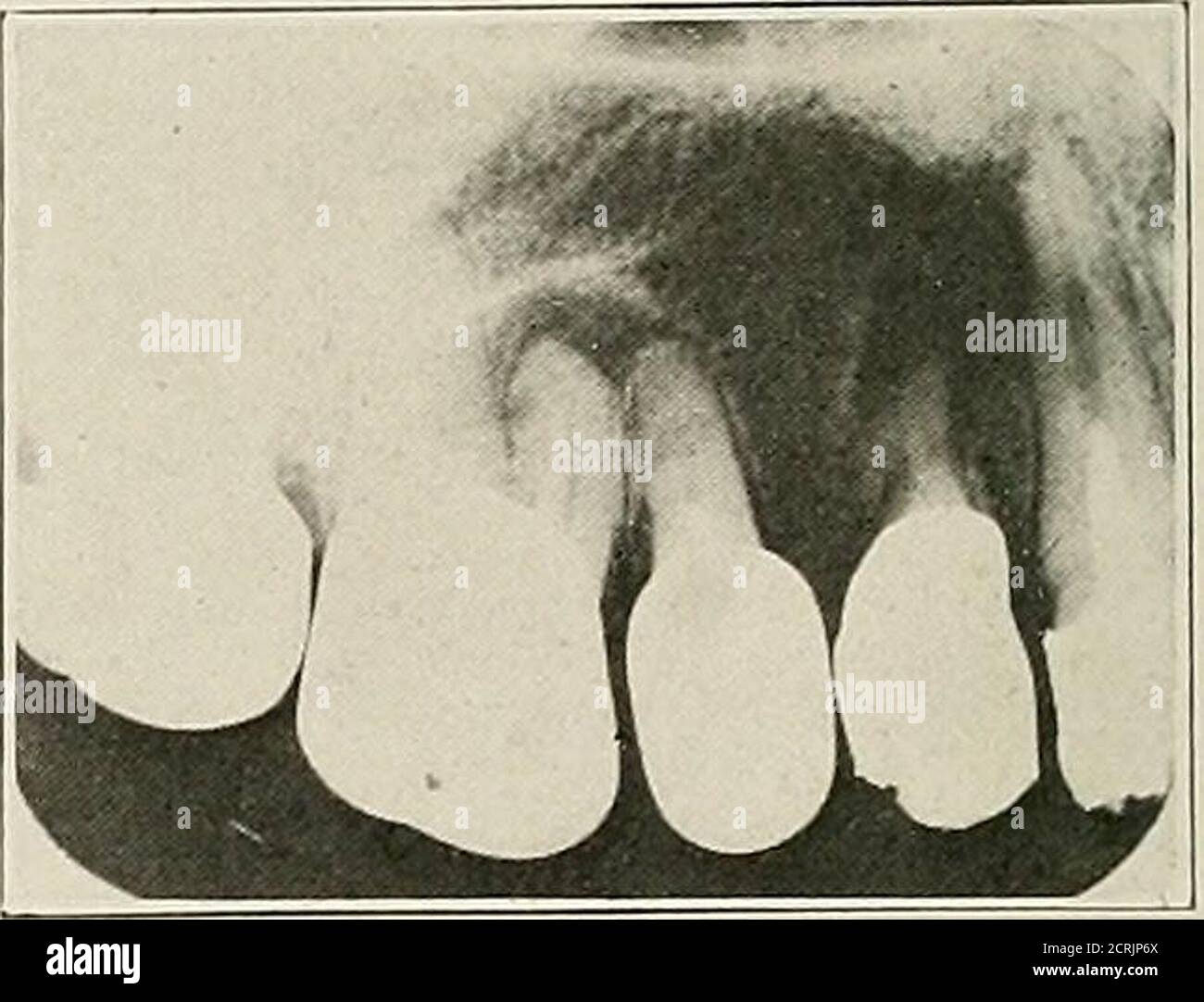Pre maxillary bone hi-res stock photography and images - Alamy