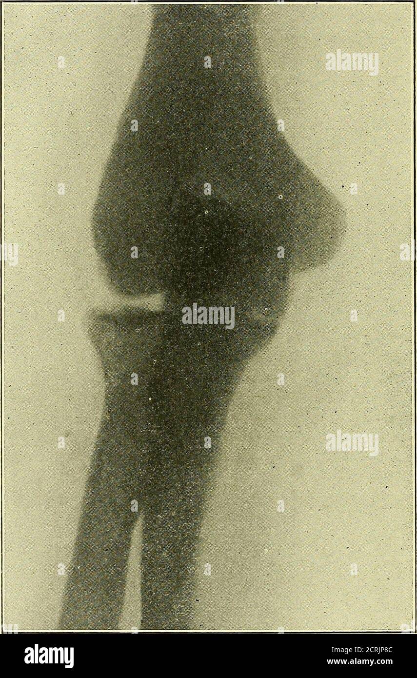 . The medical and surgical uses of electricity : including the X-ray ...