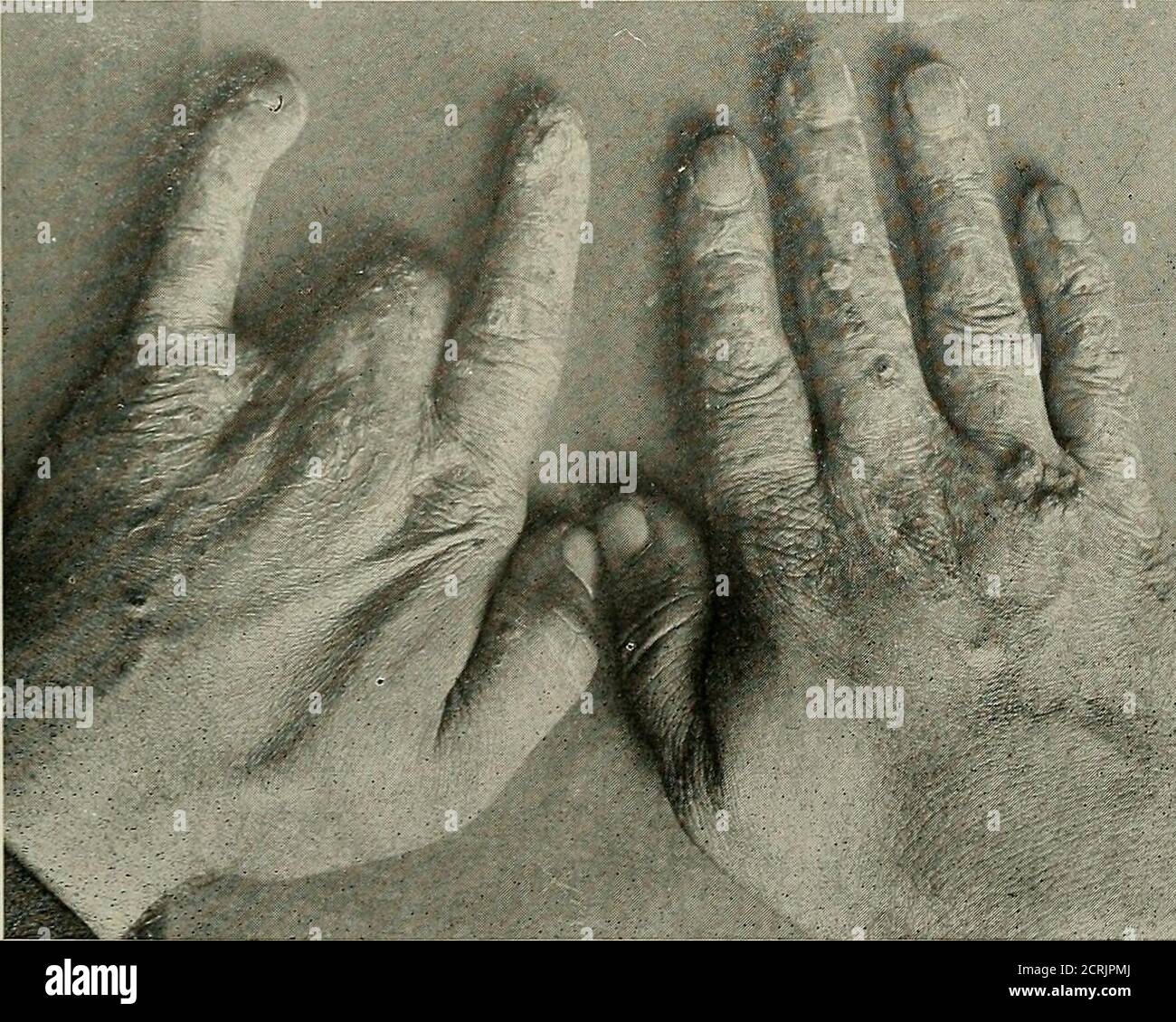 . Röntgen rays and electro-therapeutics : with chapters on radium and ...