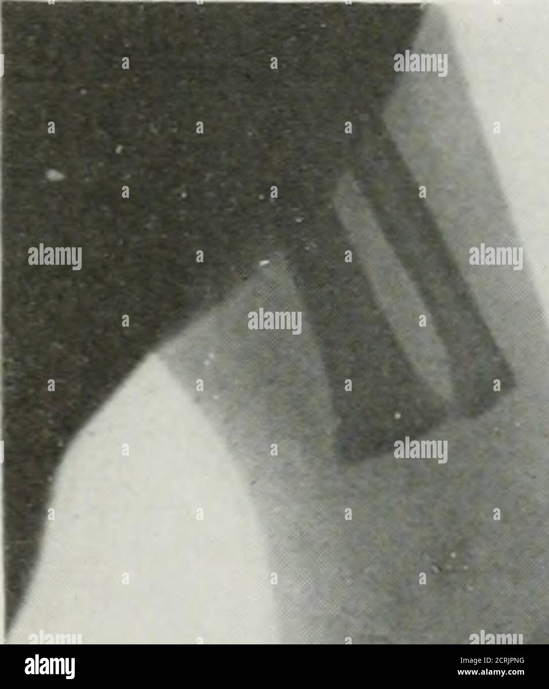 . The American journal of roentgenology, radium therapy and nuclear ...