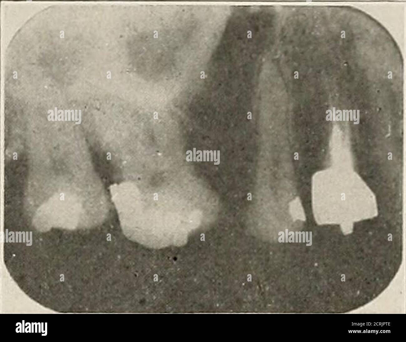 Wm 127 hi-res stock photography and images - Alamy