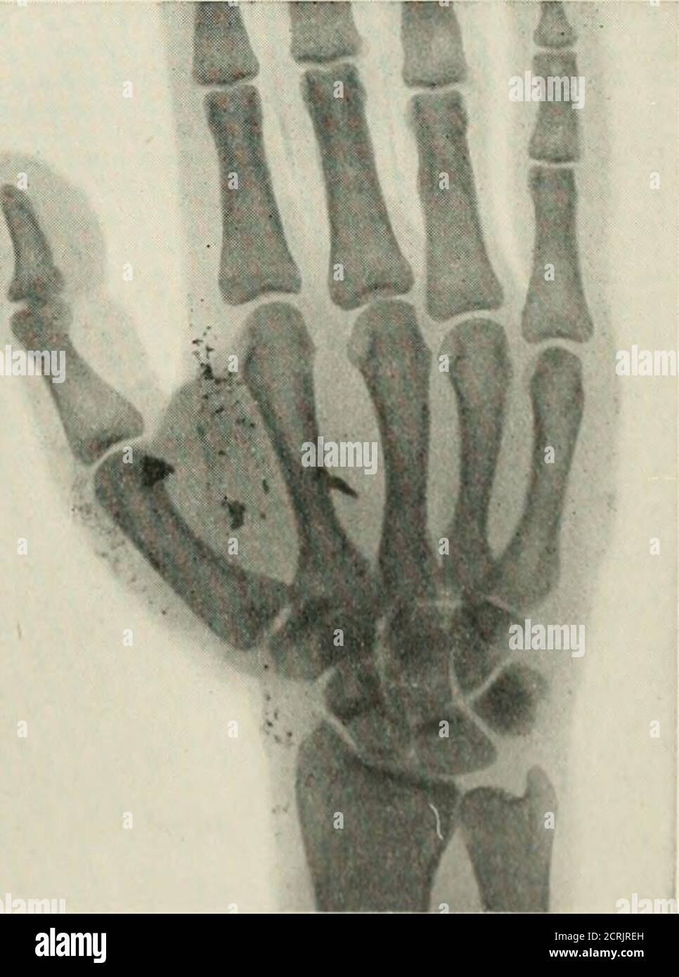 . Radiography, X-ray therapeutics and radium therapy . ; arrows ...