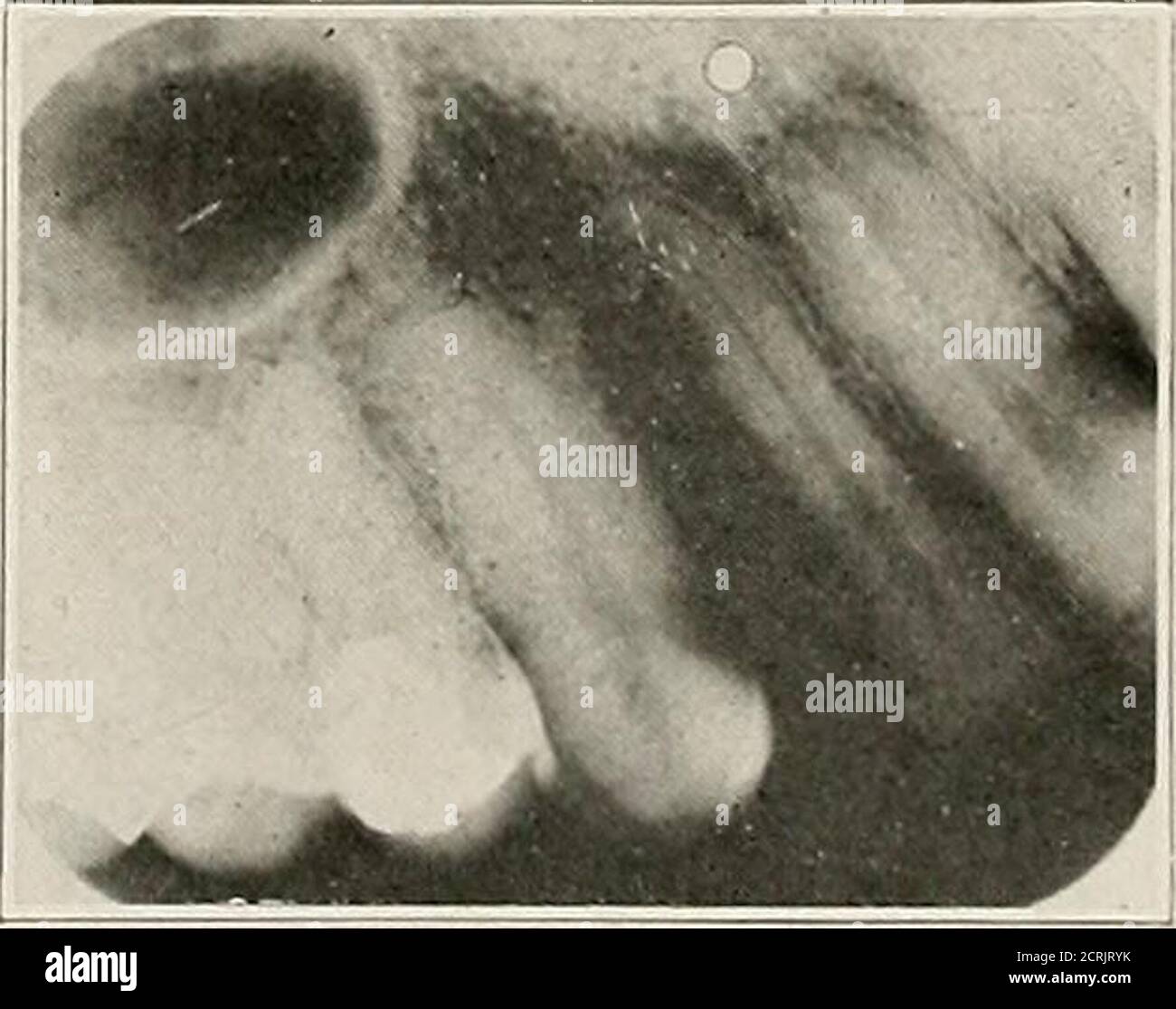 . Interpretation of dental and maxillary roentgenograms . Fig. 120. Fig ...