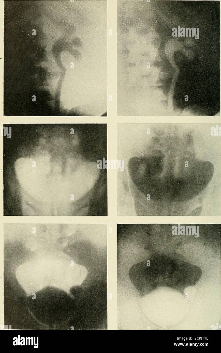 . Radiography, x-ray therapeutics and radium therapy . PLATE LI ...