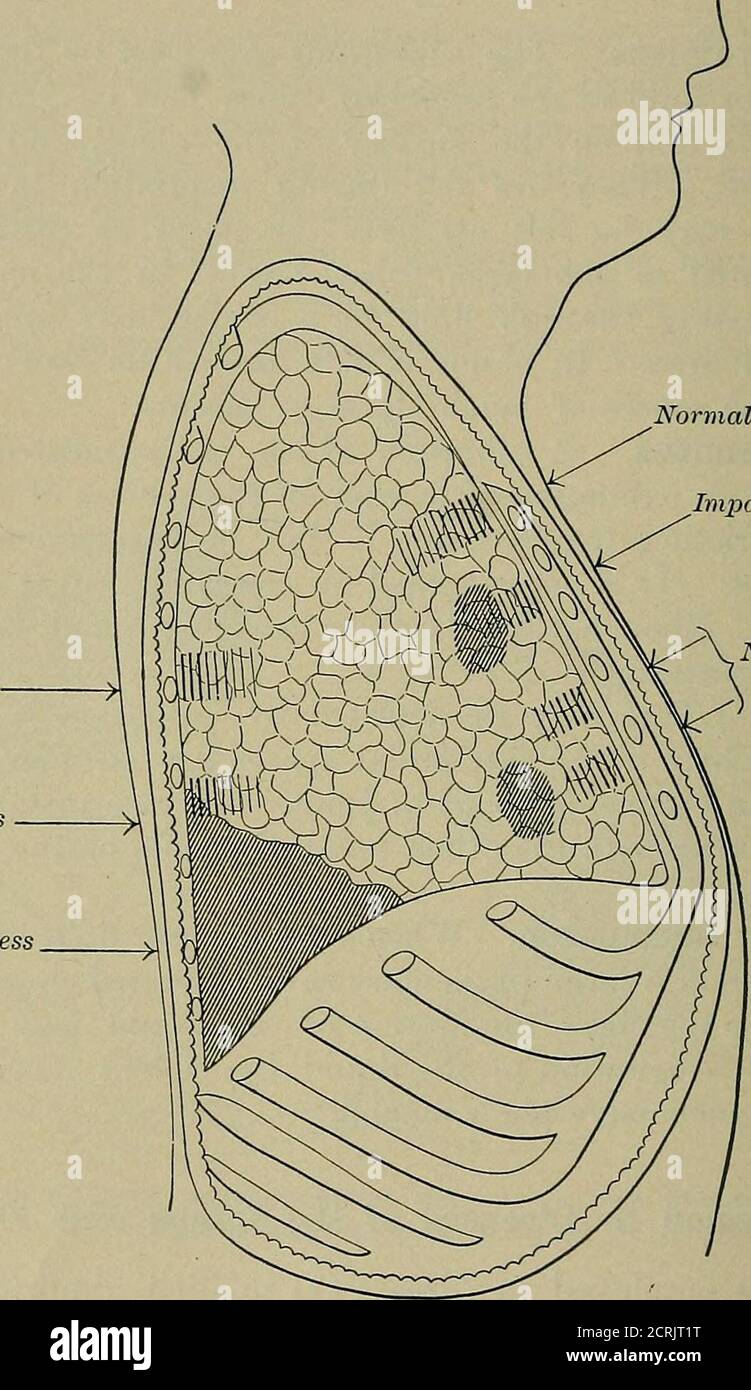 Tympany hi-res stock photography and images - Alamy