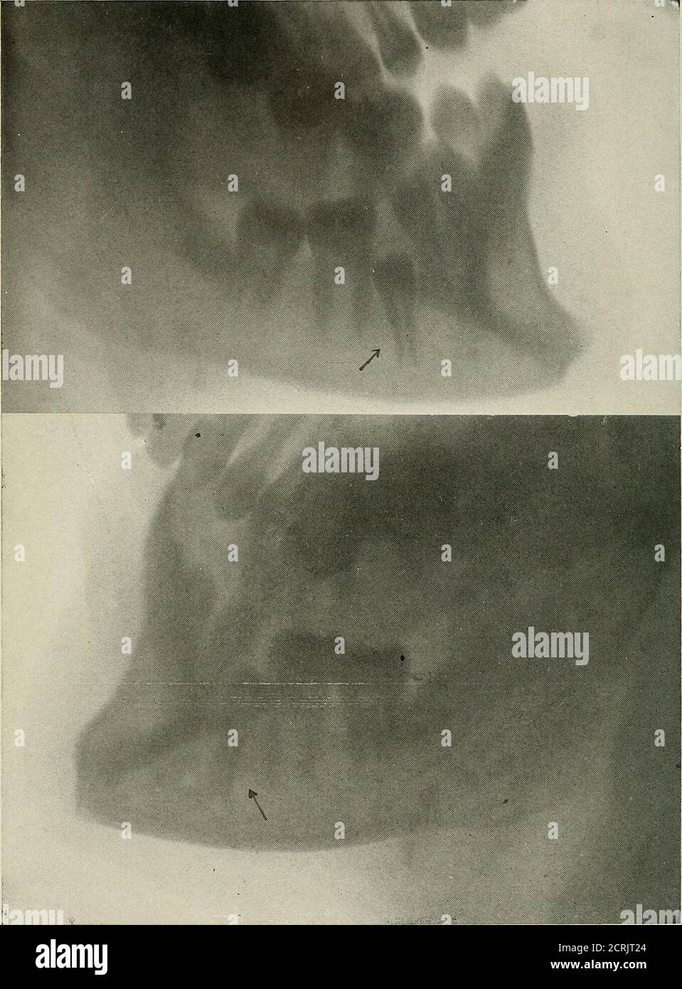 Radium girl hi-res stock photography and images - Alamy