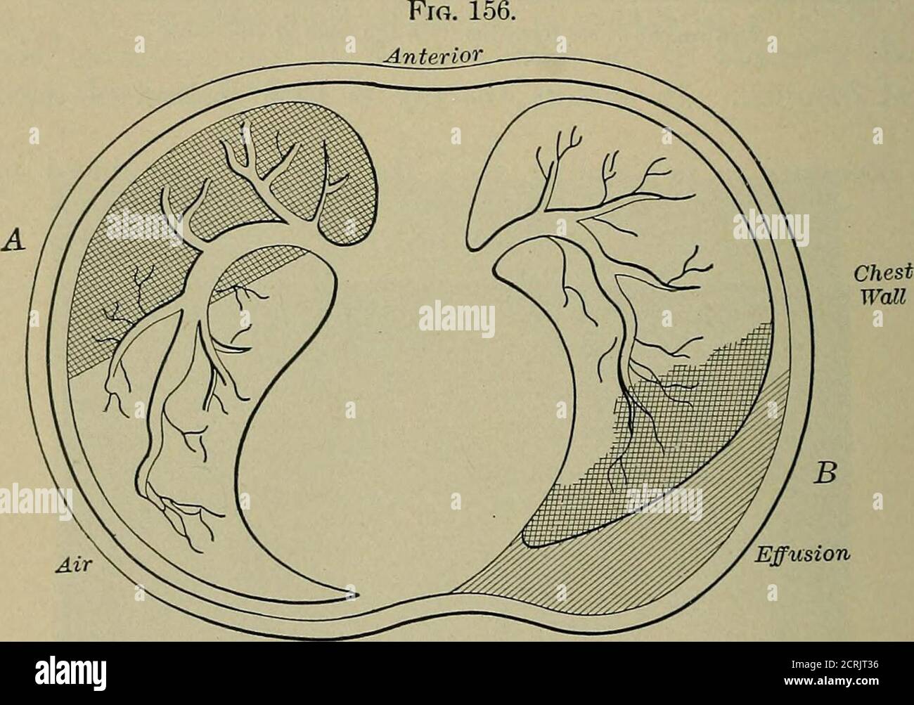 . A practical treatise on medical diagnosis for students and physicians ...