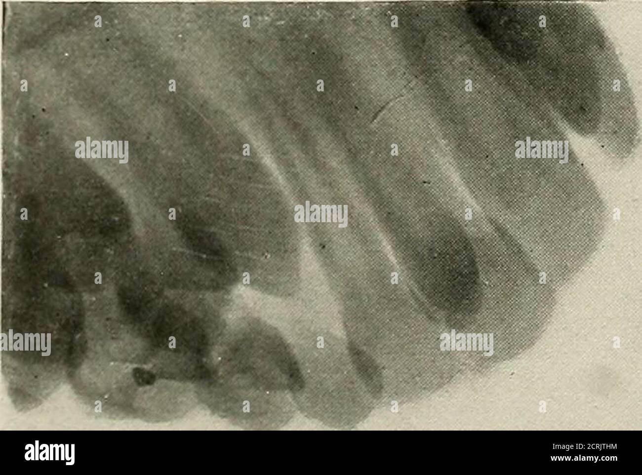. Röntgen rays and electro-therapeutics : with chapters on radium and ...