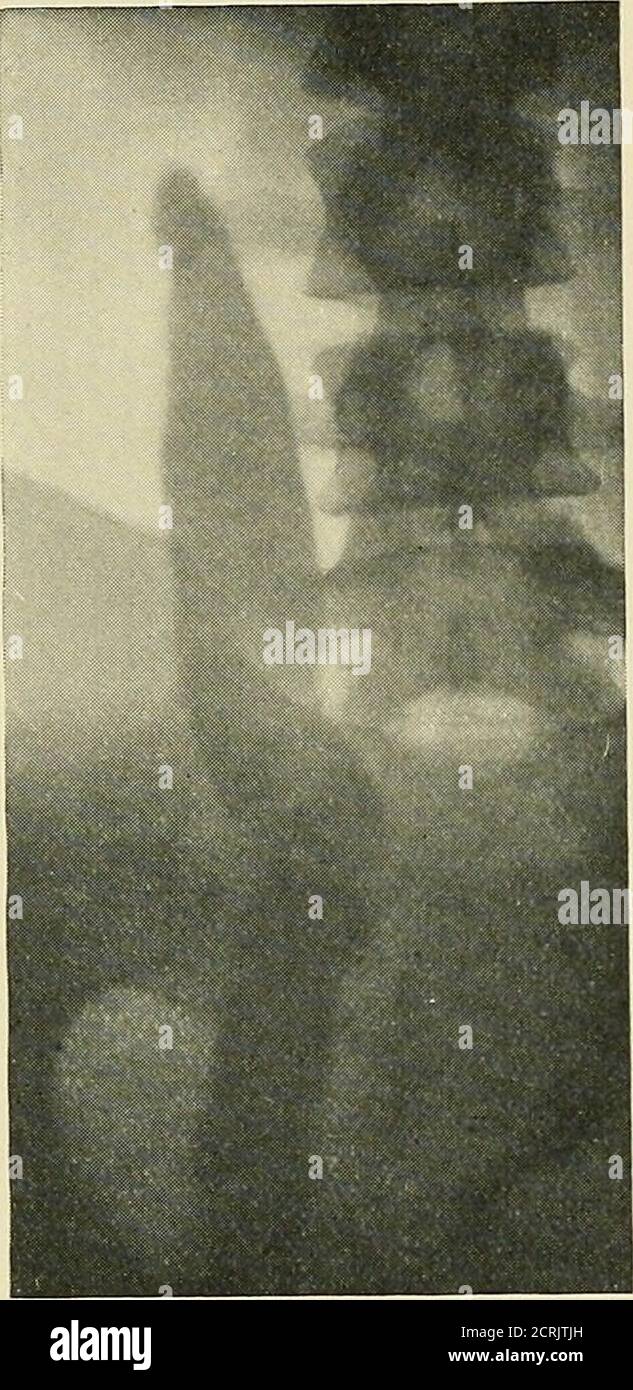 . Radiography, x-ray therapeutics and radium therapy . scopic ...