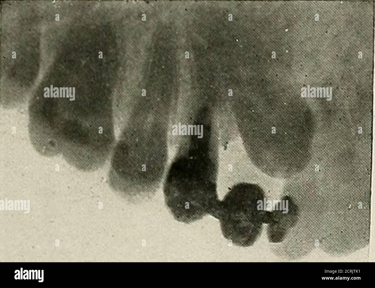 . Röntgen rays and electro-therapeutics : with chapters on radium and ...