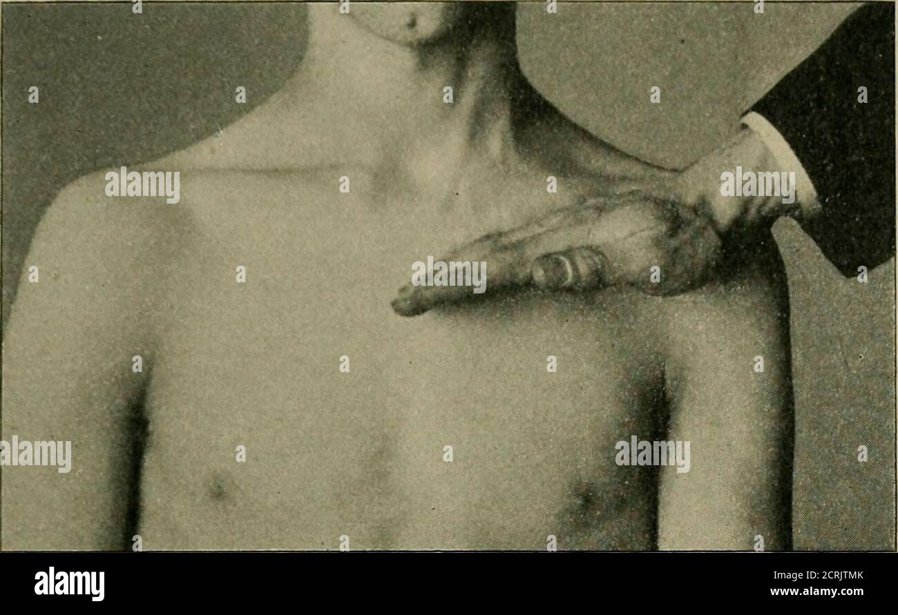 . A practical treatise on medical diagnosis for students and physicians ...