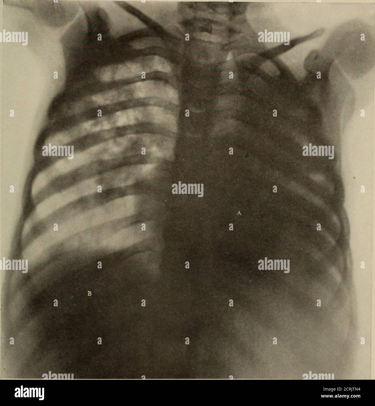 . Living anatomy and pathology; . PLATE 110. TRANSPOSITION OF ORGANS ...