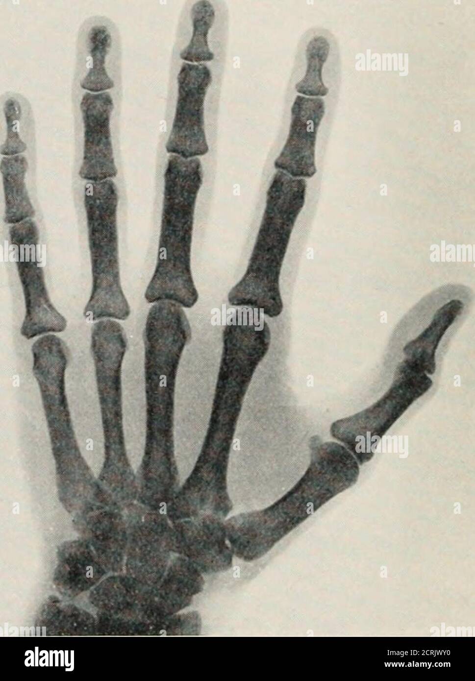 X ray being taken hi-res stock photography and images - Alamy