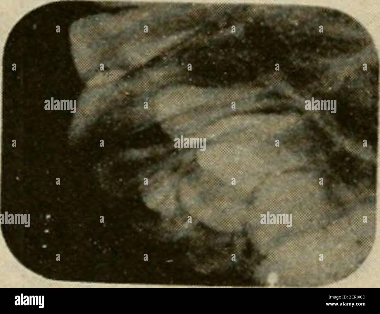 . Elementary and dental radiography / by Howard Riley Raper Stock Photo ...