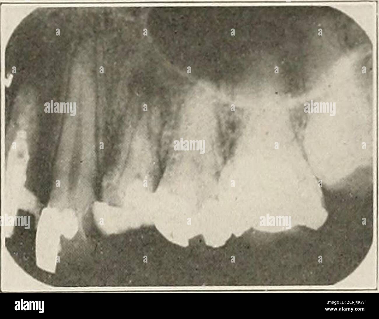 . Interpretation of dental and maxillary roentgenograms . Fig. 102. Fig ...