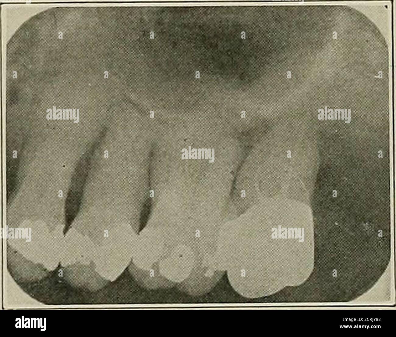 . Dental and oral radiography; a textbook for students and ...