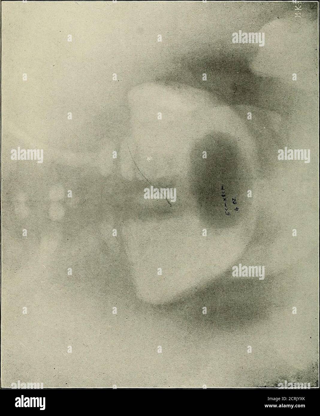 . Röntgen rays and electro-therapeutics : with chapters on radium and ...