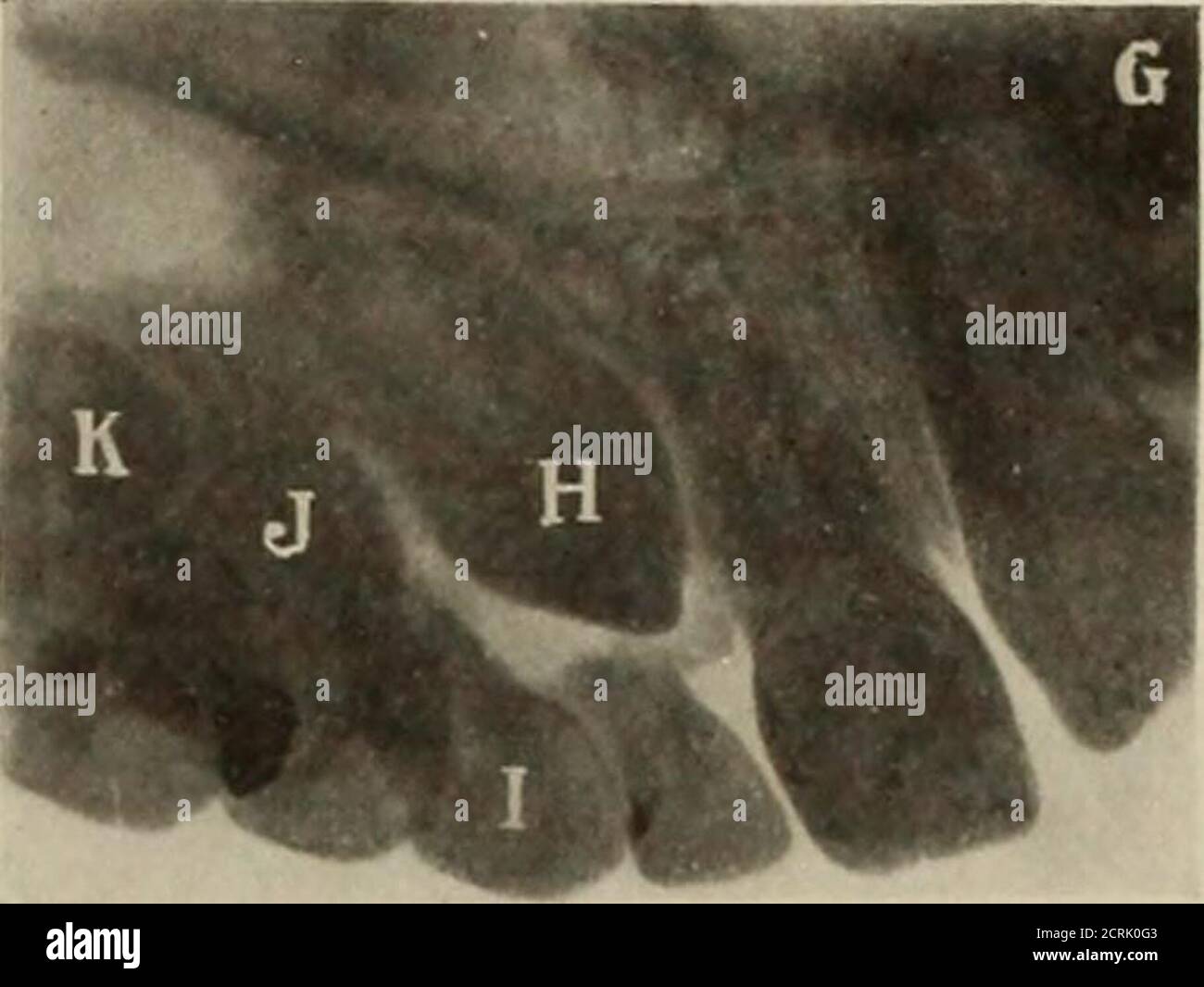 . Living anatomy and pathology; . FIG. 6.. FIG. 7 Stock Photo - Alamy