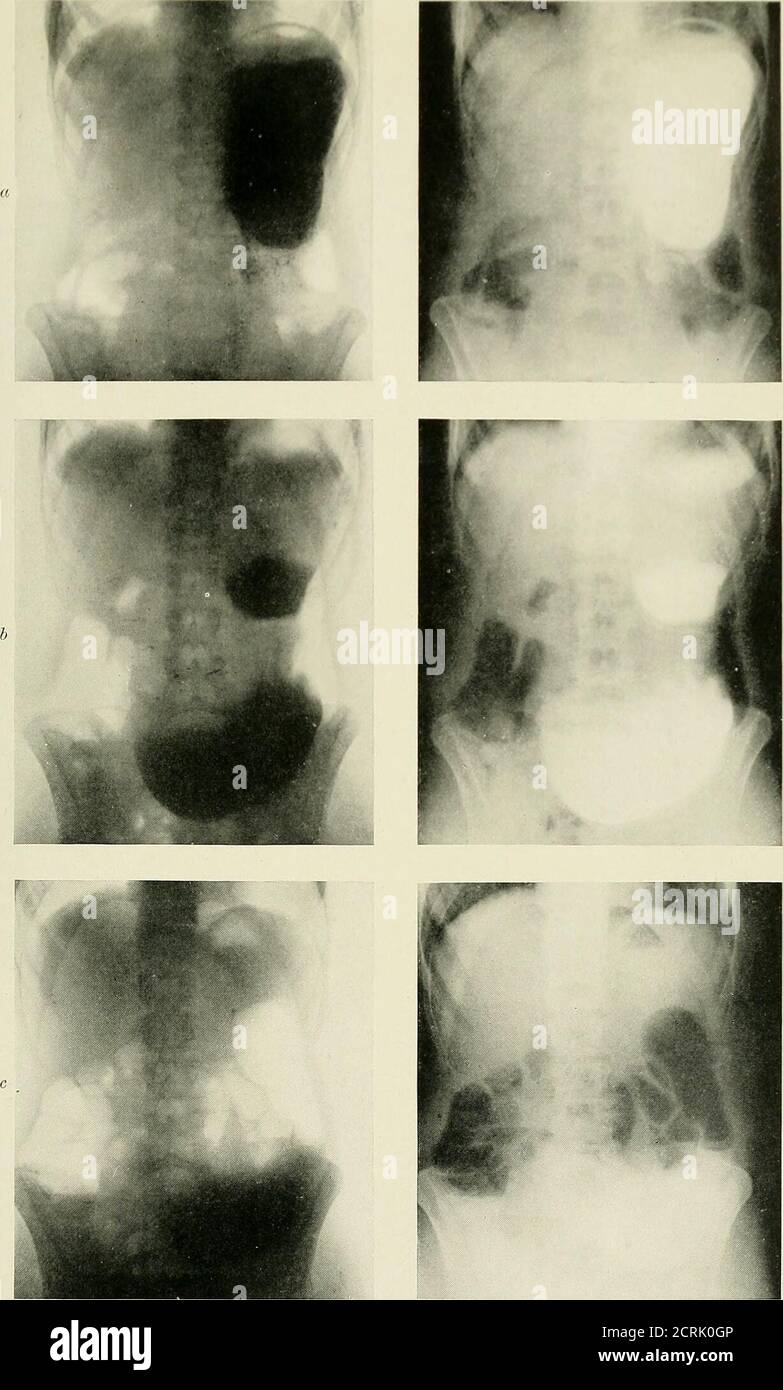 . Radiography, x-ray therapeutics and radium therapy . Upper sac ...